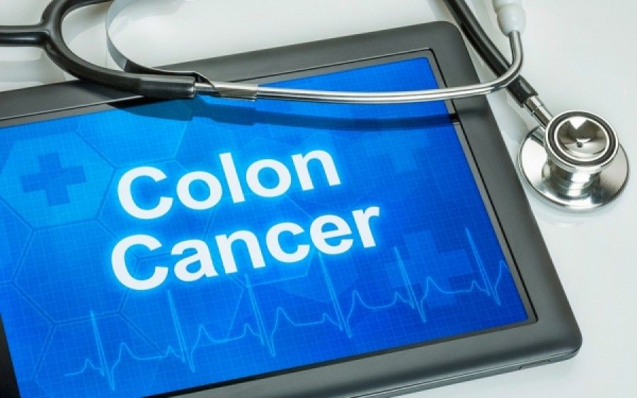 Καρκίνος του παχέος εντέρου: Συμπτώματα, στάδια και παράγοντες κινδύνου