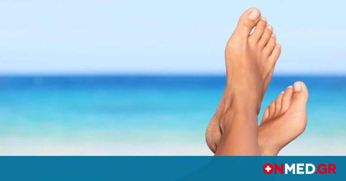 Μύκητες στα πόδια: Αναγνωρίστε τους και αντιμετωπίστε τους φυσικά