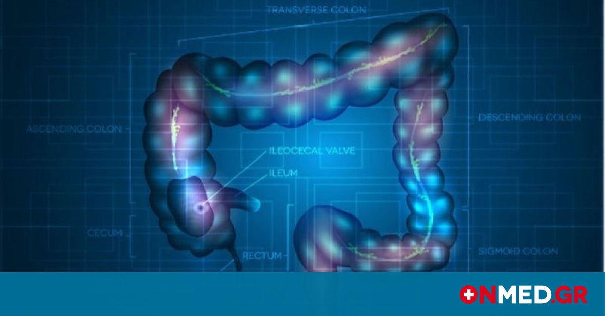 Πότε οι ενοχλήσεις στην κοιλιά δείχνουν σκωληκοειδίτιδα