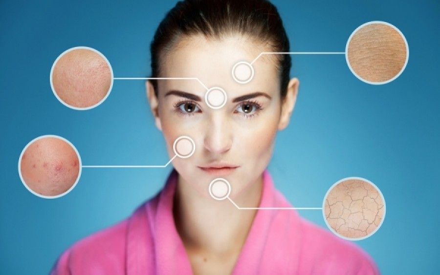 Δερματικά προβλήματα: Αναγνωρίστε τα μέσα από φωτογραφίες