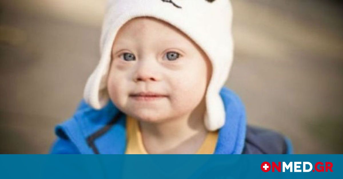Σύνδρομο Down: «Ακόμη και τα λουλούδια διαφέρουν, αλλά όλα είναι όμορφα…»