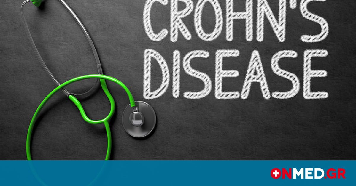 Νόσος του Crohn: Πώς συνδέεται με τη γνωστική δυσλειτουργία
