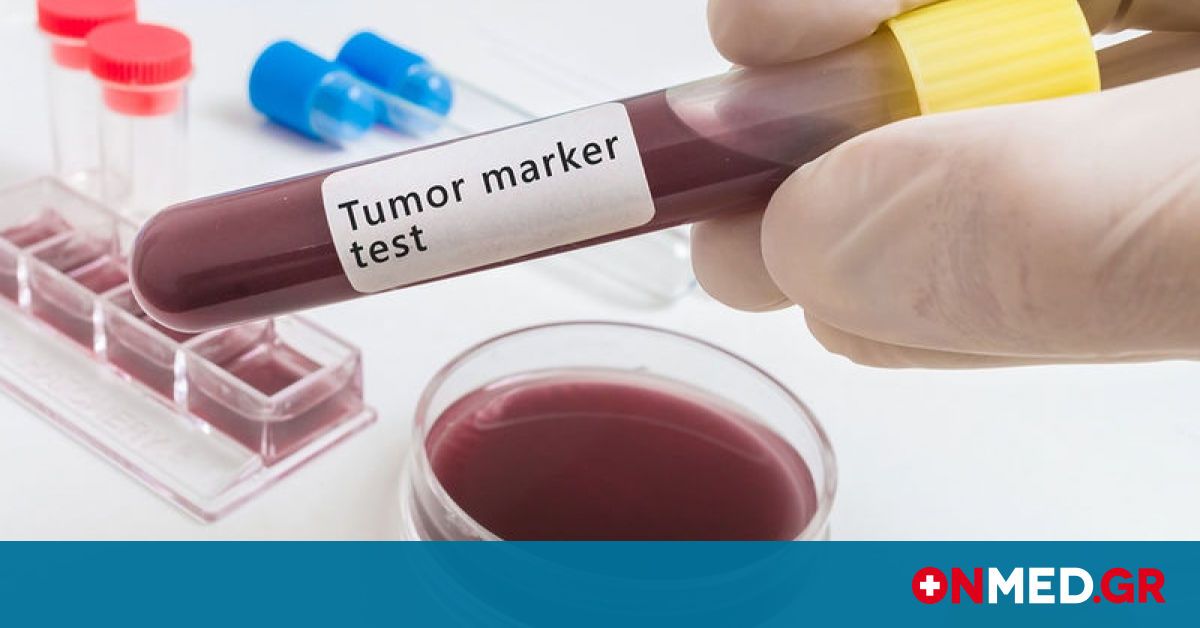 Καρκινικοί δείκτες: Τι είναι & πώς συμβάλλουν στην πρόγνωση του καρκίνου
