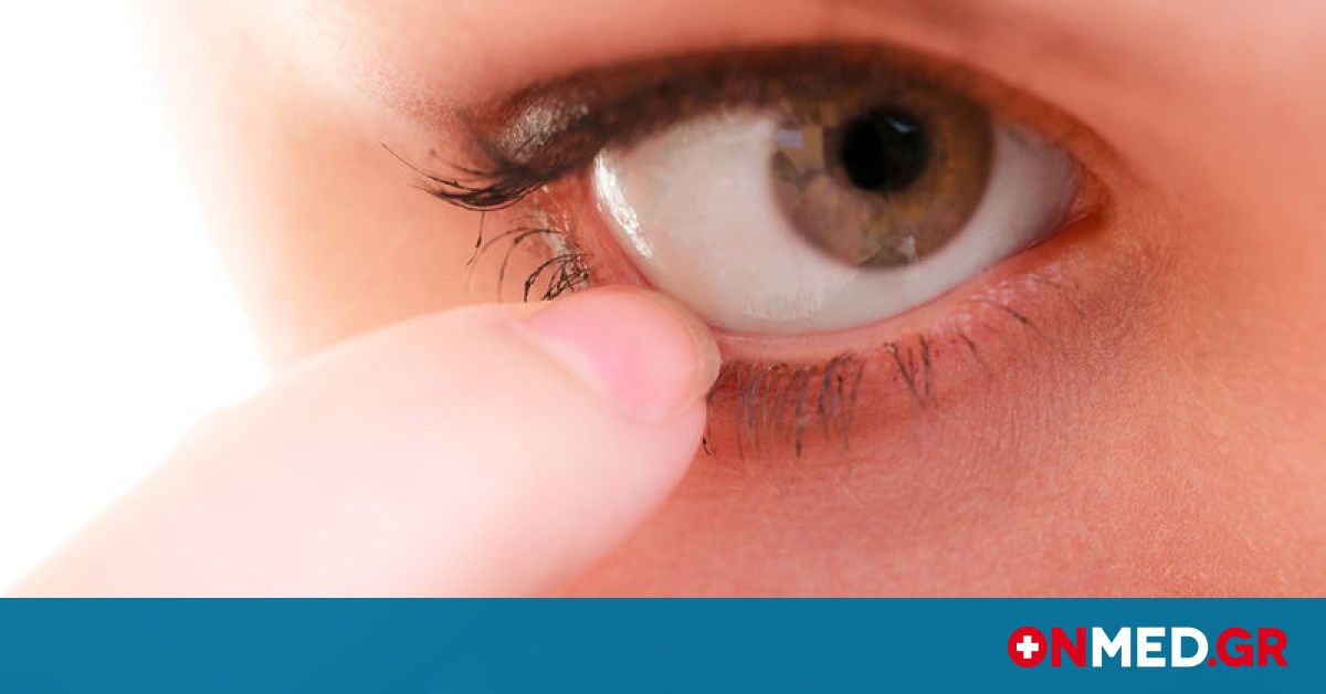 Γιατί «πετάει» το μάτι; Οι κοινές και οι σοβαρές αιτίες