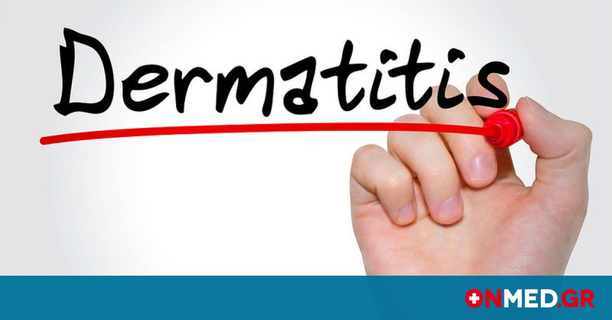 Ατοπική Δερματίτιδα: Θεραπεία των Sanofi & Regeneron εγκρίθηκε από την ΕΕ