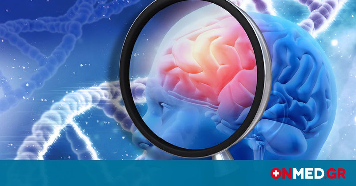 Αλτσχάιμερ: Ο ρόλος της ζάχαρης στην ανάπτυξη της νόσου