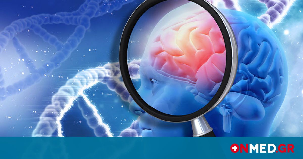 Ατροφία εγκεφάλου: Με ποια έλλειψη βιταμινών συνδέεται