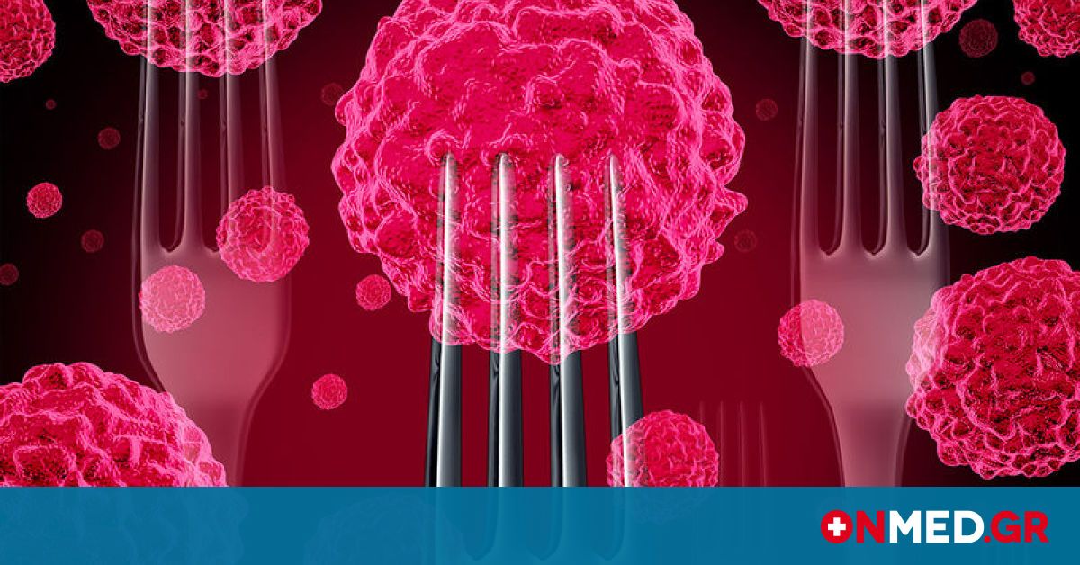 Προσοχή: Οι 5 τροφές που αυξάνουν τον κίνδυνο καρκίνου (pics)