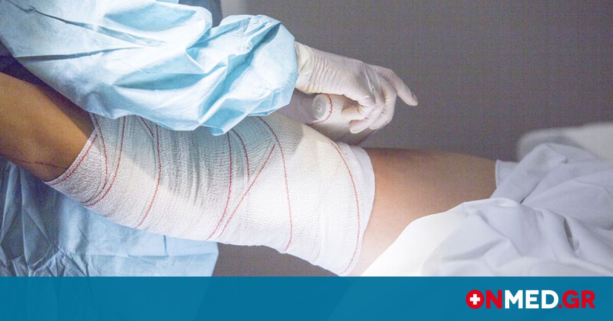Ρήξη μηνίσκου: Πώς θα γλιτώσεις το χειρουργείο