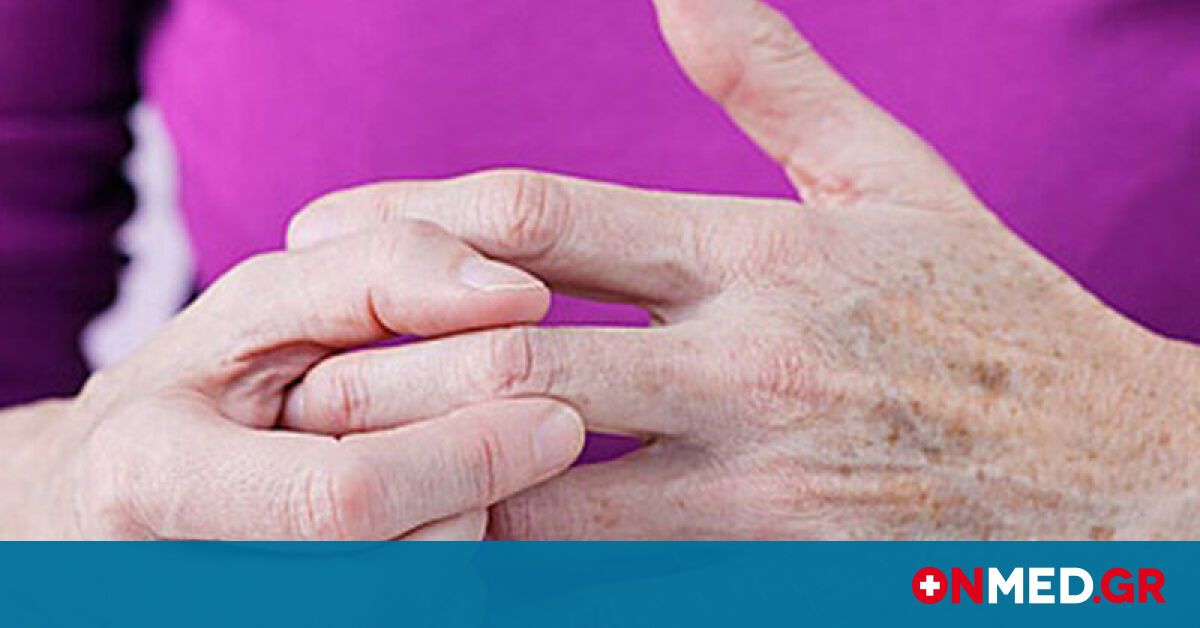 Οστεοαρθρίτιδα: Είναι κληρονομική;