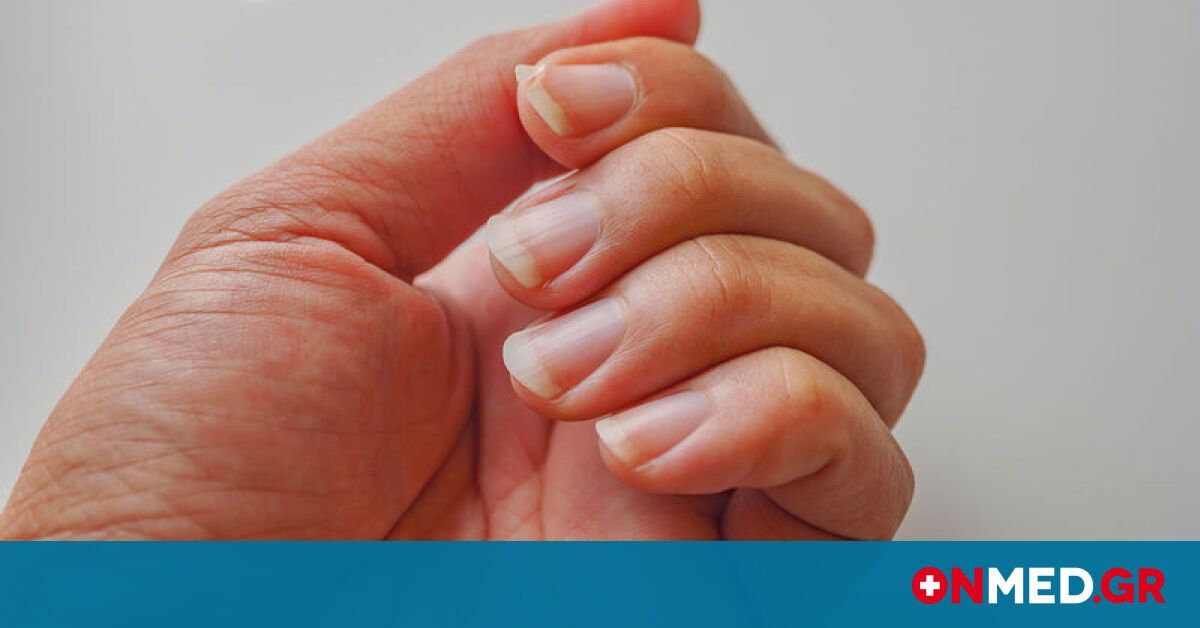 Νύχια: Οι 7 καθημερινές συνήθειες που τα καταστρέφουν (pics)