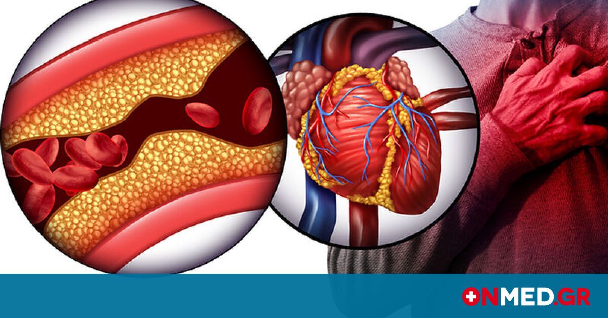 Καρδιακός αποκλεισμός: Πώς θα προλάβετε την επικίνδυνη διαταραχή του ...