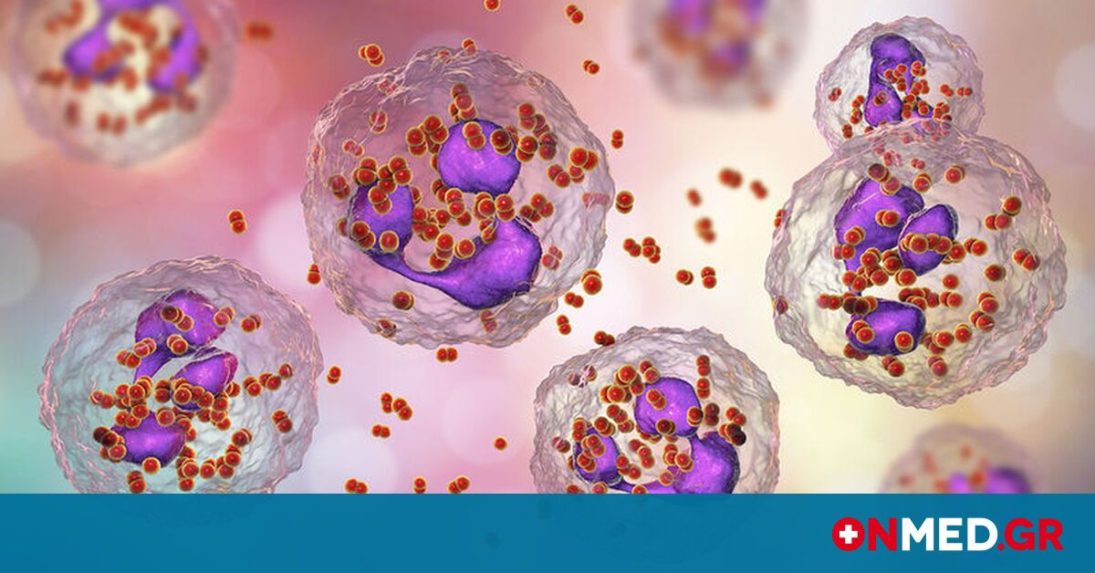 Γονόρροια: Τα συμπτώματα που δεν πρέπει να αγνοήσετε (εικόνες)