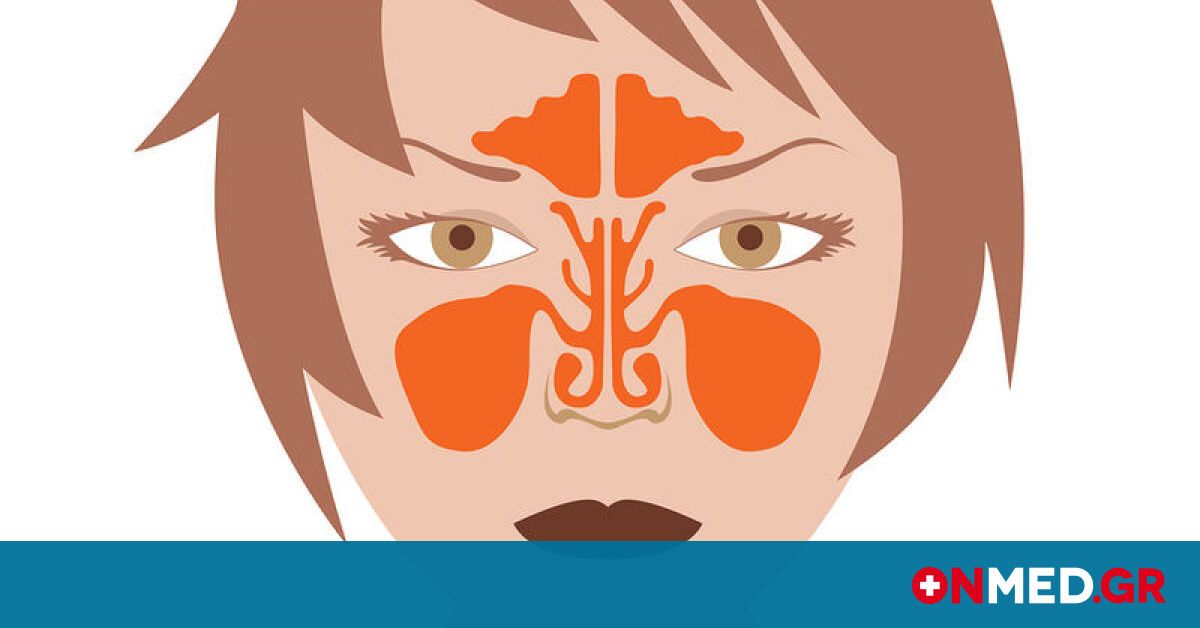 Σκολίωση ρινικού διαφράγματος: Ο ρόλος του χειρουργείου στη βελτίωση ...