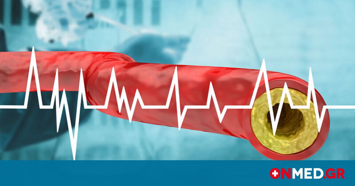Υψηλή χοληστερόλη: 7 σημάδια που δεν πρέπει να αγνοείτε (video)
