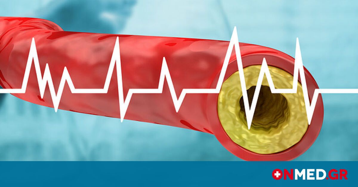 Φρούτα και λαχανικά που ρίχνουν τη χοληστερίνη (εικόνες)
