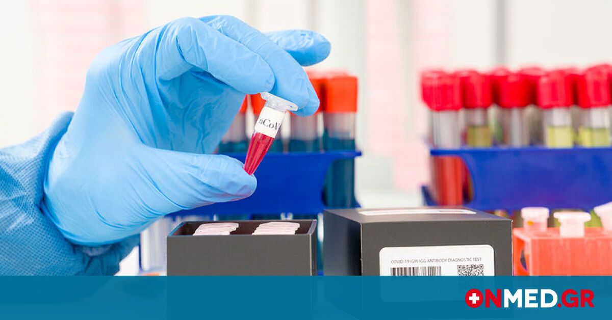 Κορονοϊός: Δωρεάν τεστ Covid σήμερα στη Νίκαια