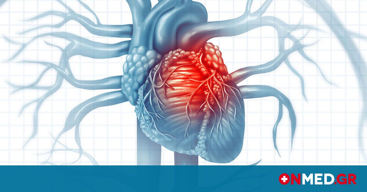 Καρδιαγγειακές παθήσεις: Η διατροφή που μειώνει τον κίνδυνο