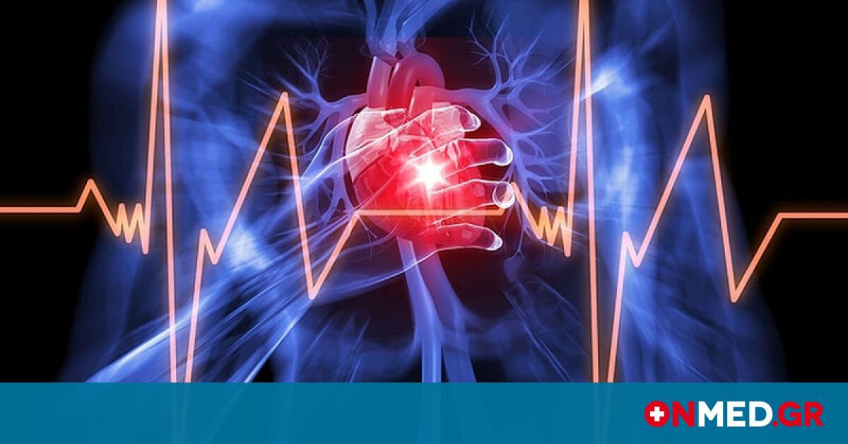 Έμφραγμα μυοκαρδίου: 6 άγνωστοι παράγοντες κινδύνου (εικόνες)
