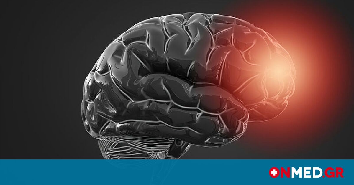 Εγκεφαλικό: Ποιοι ανήκουν στις ομάδες υψηλού κινδύνου (εικόνες)