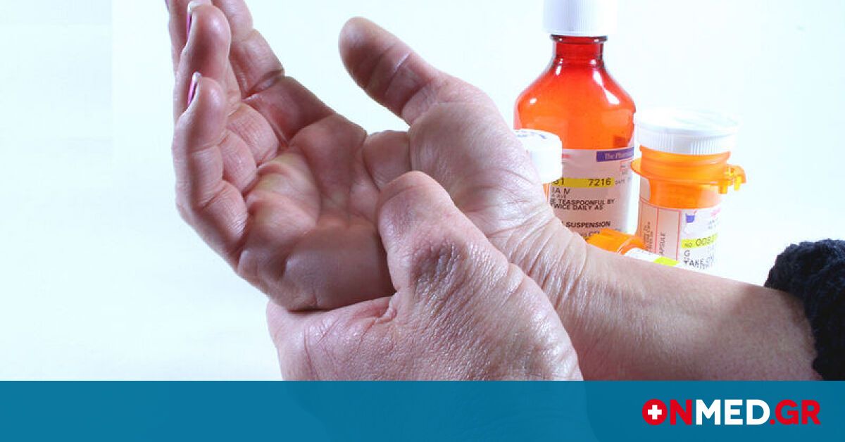 Ρευματοειδής αρθρίτιδα: Φυσικές λύσεις για να μειώσετε τους πόνους ...