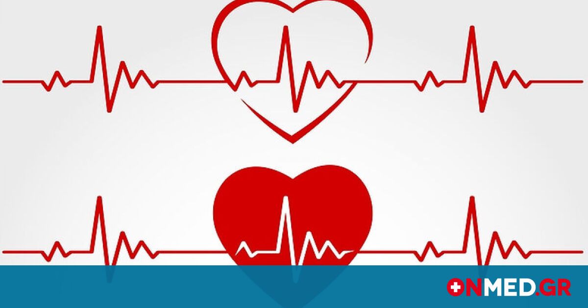 Φτερούγισμα στην καρδιά: Ποιες είναι οι πιθανές αιτίες (εικόνες)