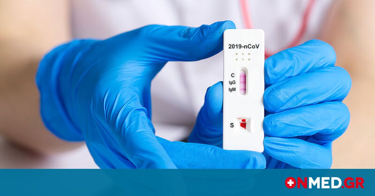 Οδηγίες για την ορθή χρήση των διαγνωστικών rapid τεστ για τον SARS-CoV-2