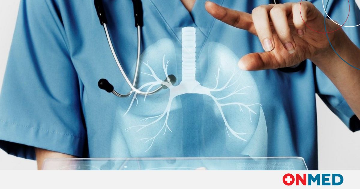 Τρόποι θεραπείας του προχωρημένου μη μικροκυτταρικού καρκίνου του πνεύμονα