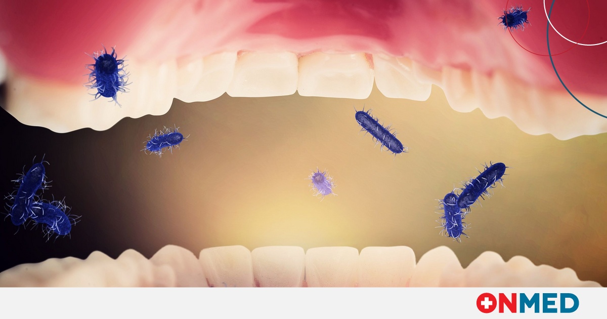 Νόσος του Crohn: Πώς συνδέεται με τα βακτήρια του στόματος