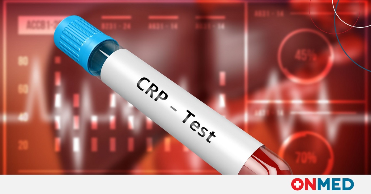 CRP: Τι δείχνει η εξέταση της C-αντιδρώσας πρωτεΐνης;