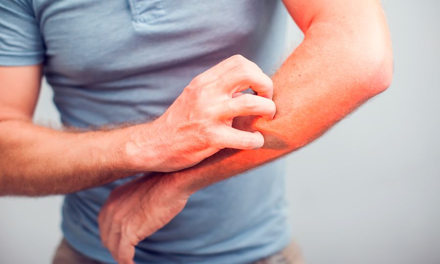 Δερματίτιδα: Αναγνωρίστε τα σημάδια μέσα από εικόνες